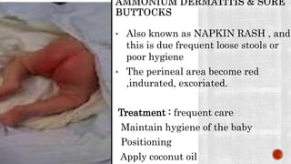 Minor disorders of newborn 1 | PPTX