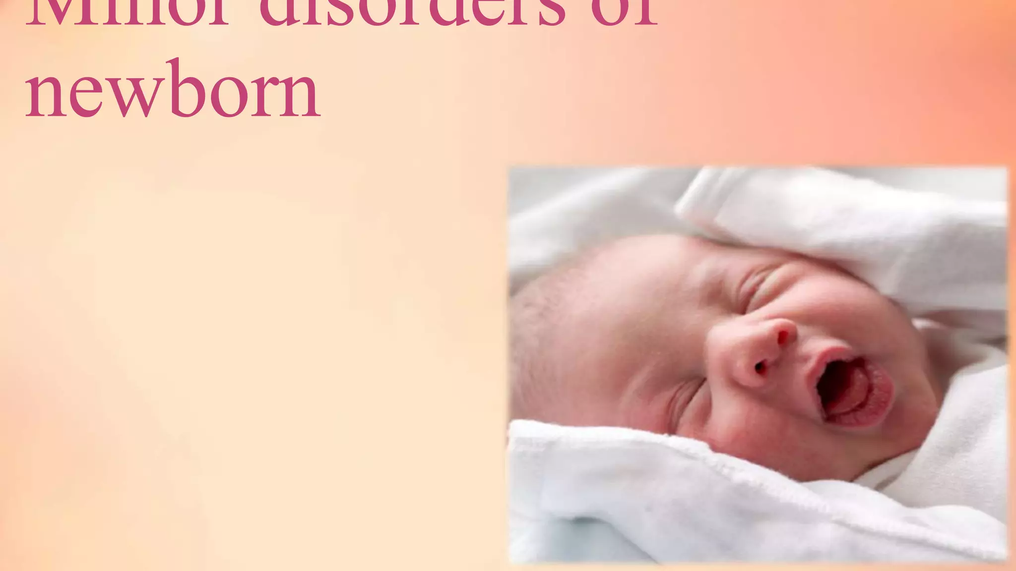 minor disorders of neonates and its management - shani -ppt- slideshare ...