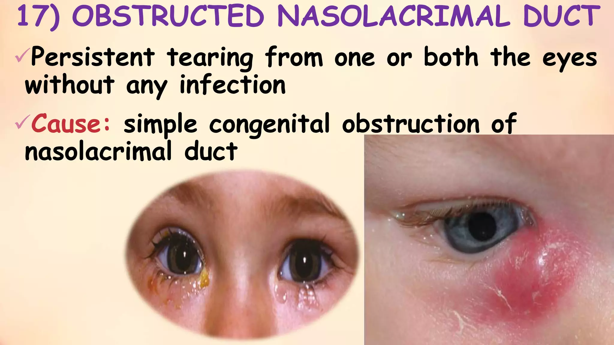 minor disorders of neonates and its management - shani -ppt- slideshare ...