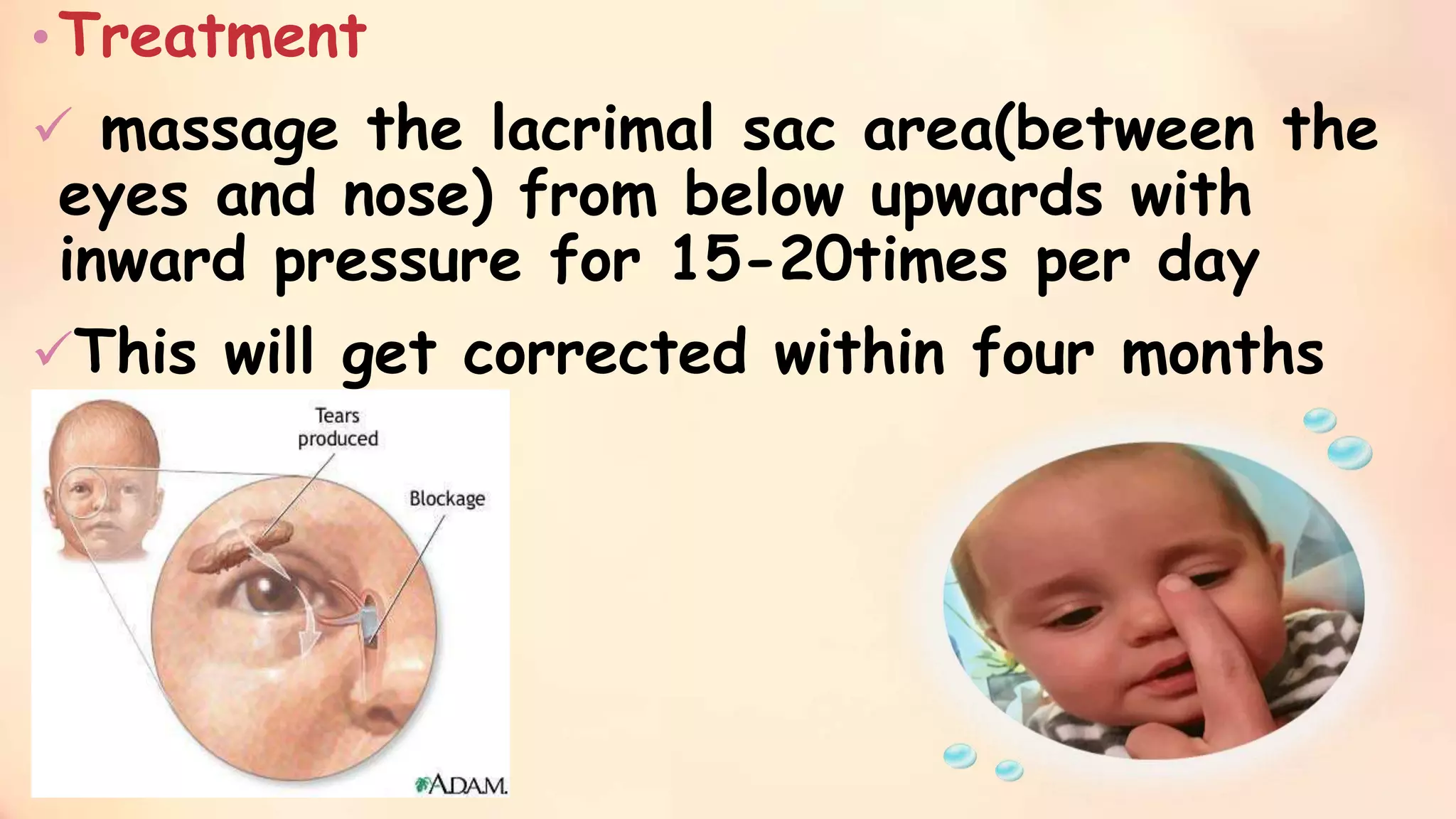 minor disorders of neonates and its management - shani -ppt- slideshare ...