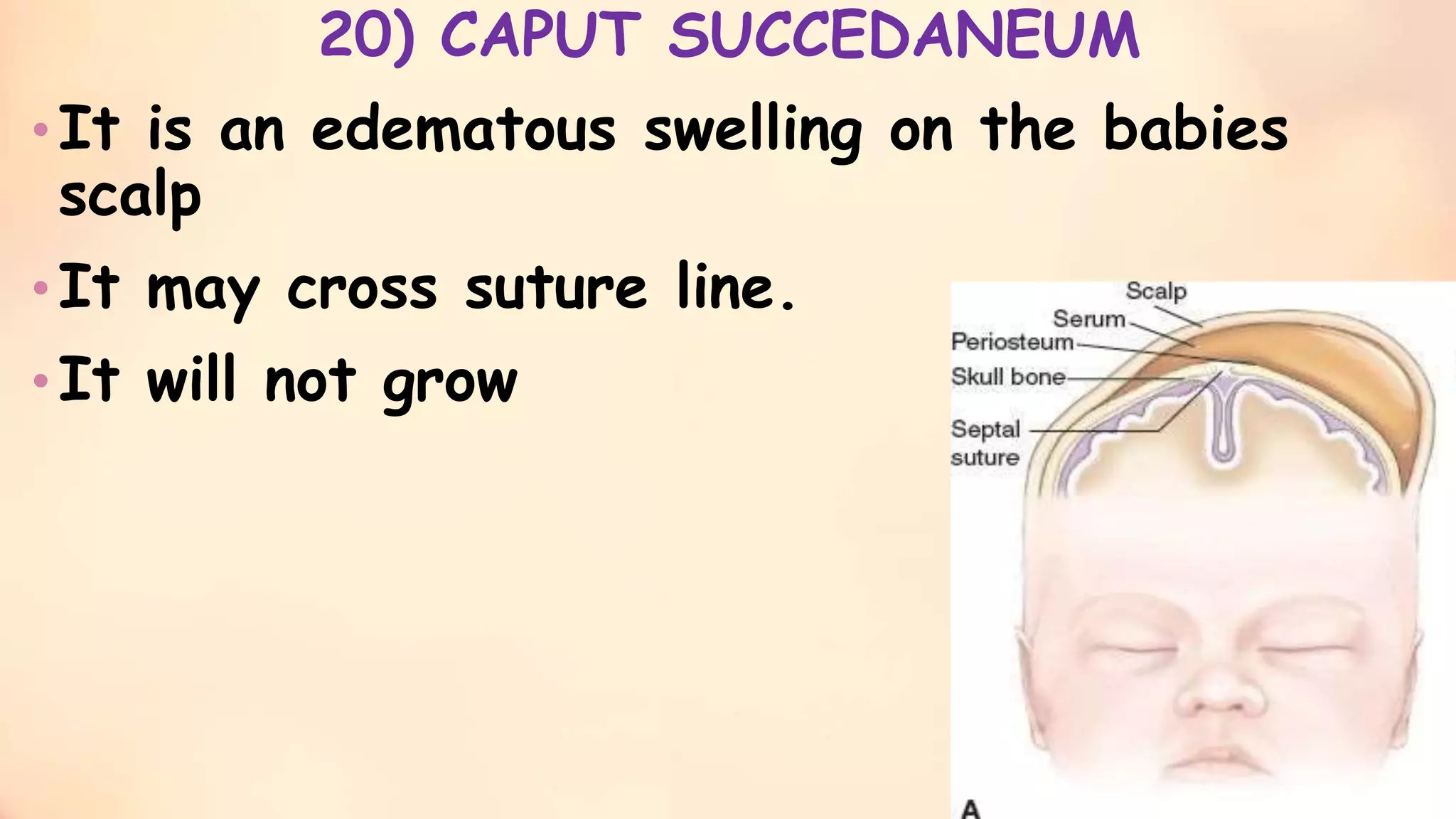 minor disorders of neonates and its management - shani -ppt- slideshare ...