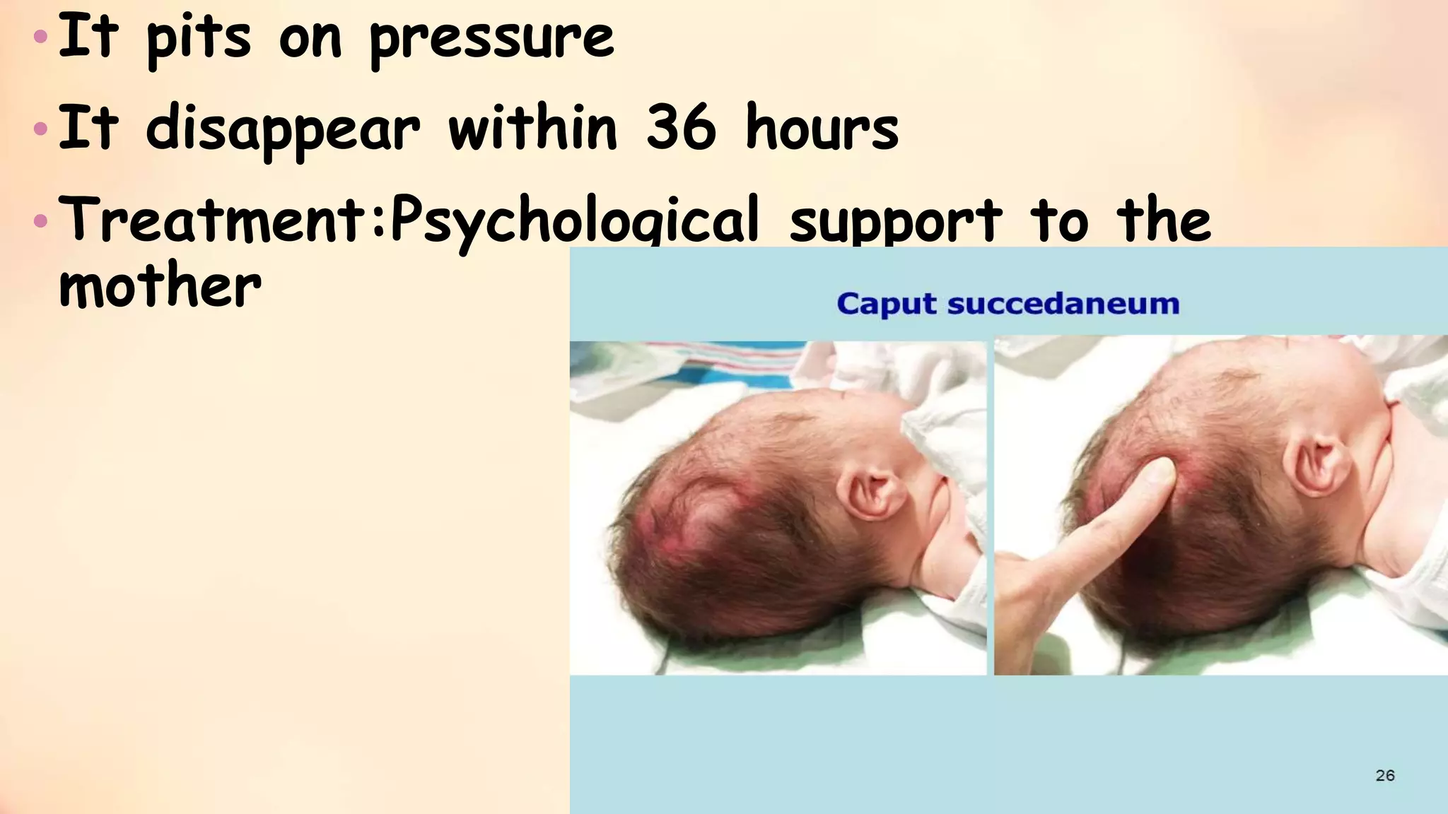 Minor Disorders Of Neonates And Its Management Shani Ppt Slideshare