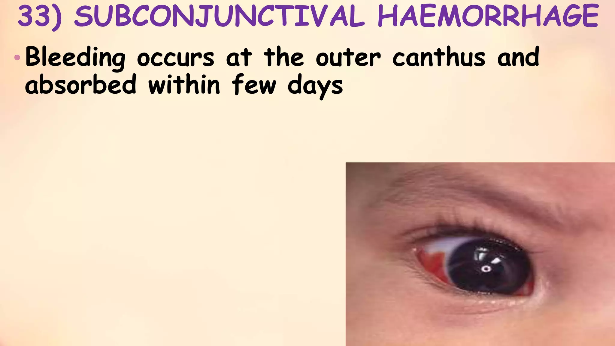 Minor Disorders Of Neonates And Its Management Shani Ppt Slideshare