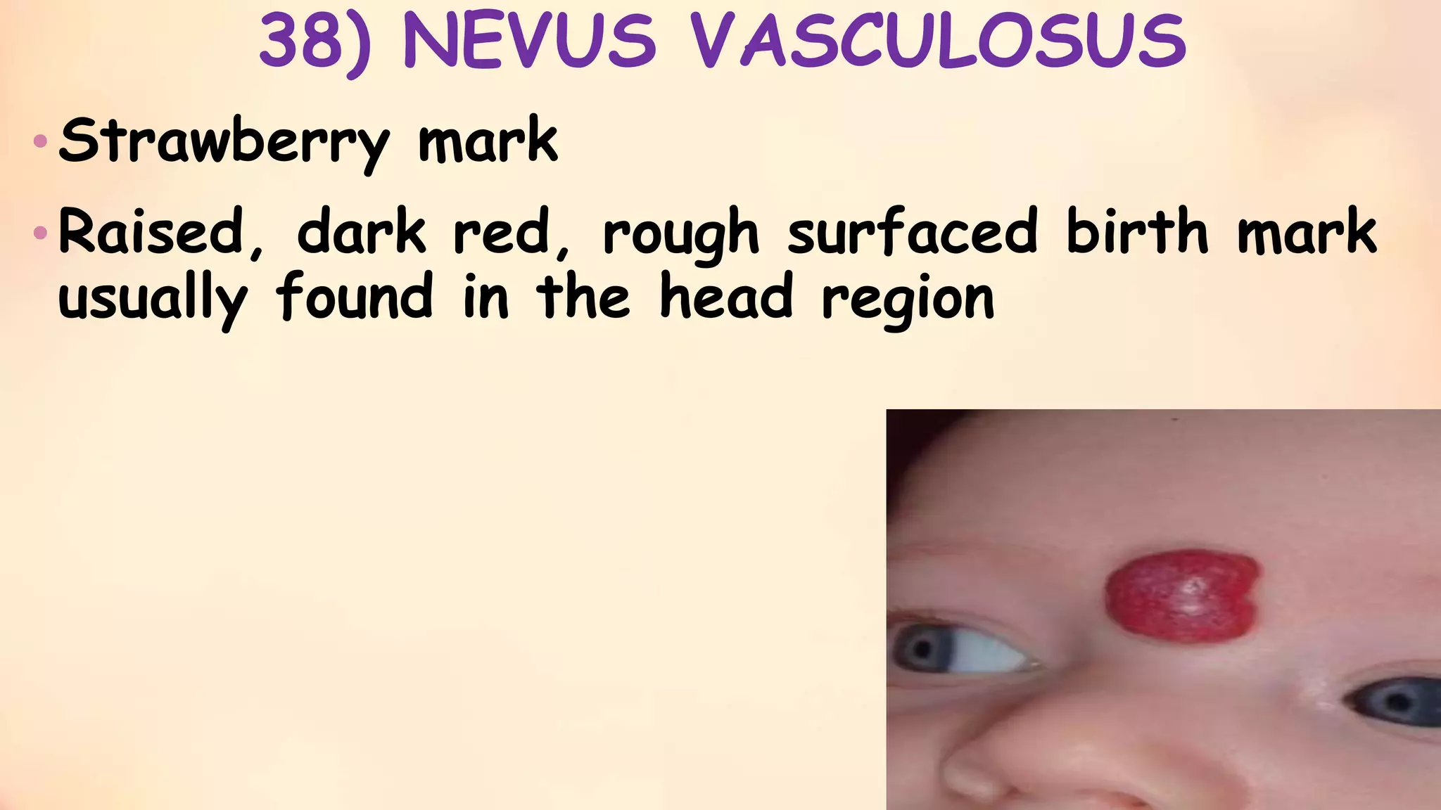 minor disorders of neonates and its management - shani -ppt- slideshare ...