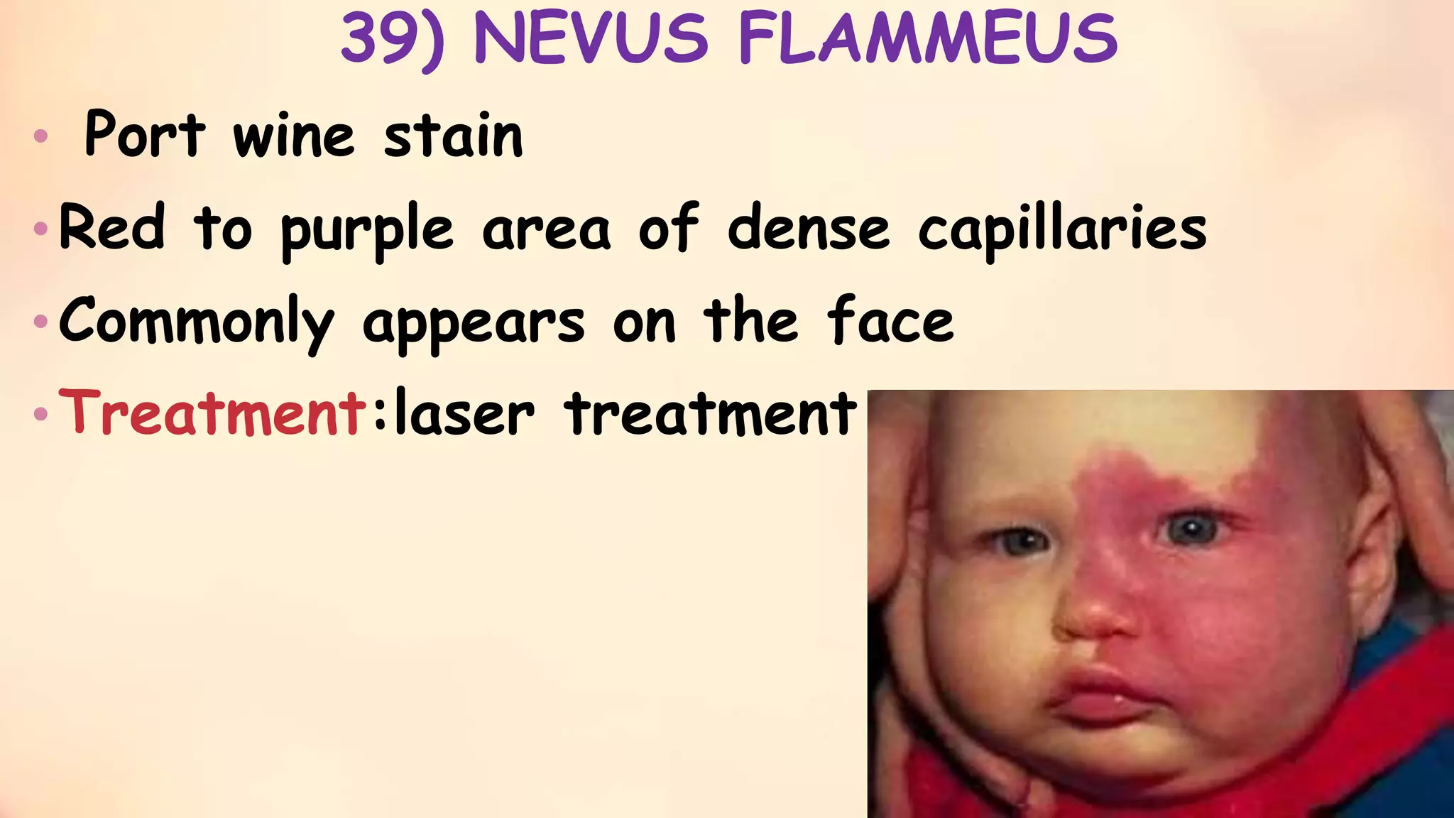 minor disorders of neonates and its management - shani -ppt- slideshare ...