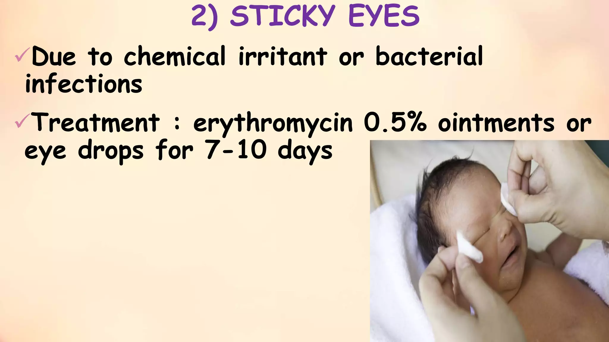 minor disorders of neonates and its management - shani -ppt- slideshare ...