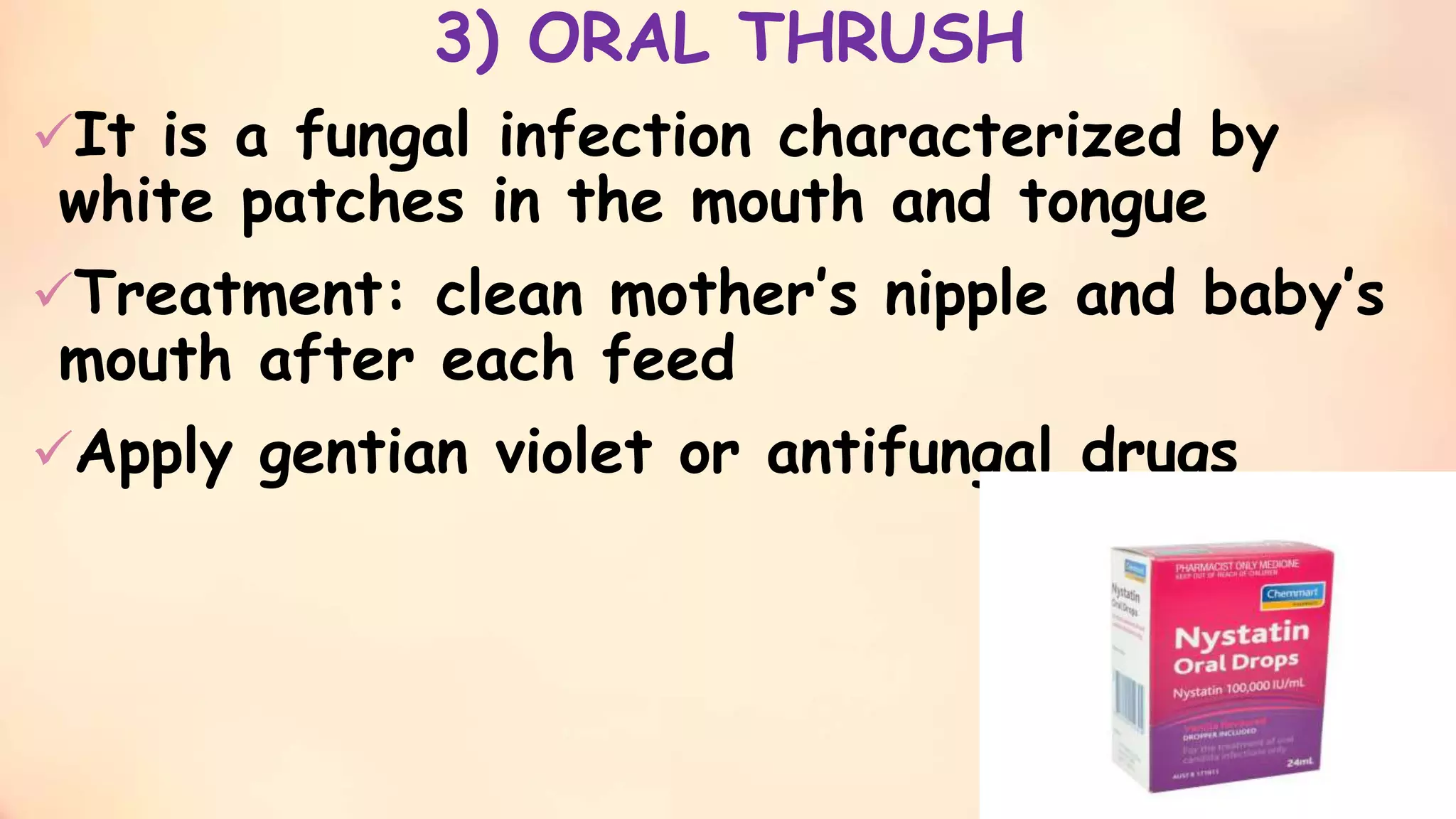 minor disorders of neonates and its management - shani -ppt- slideshare ...