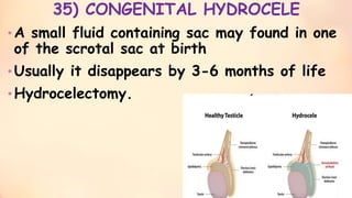 minor disorders of neonates and its management - shani -ppt- slideshare ...