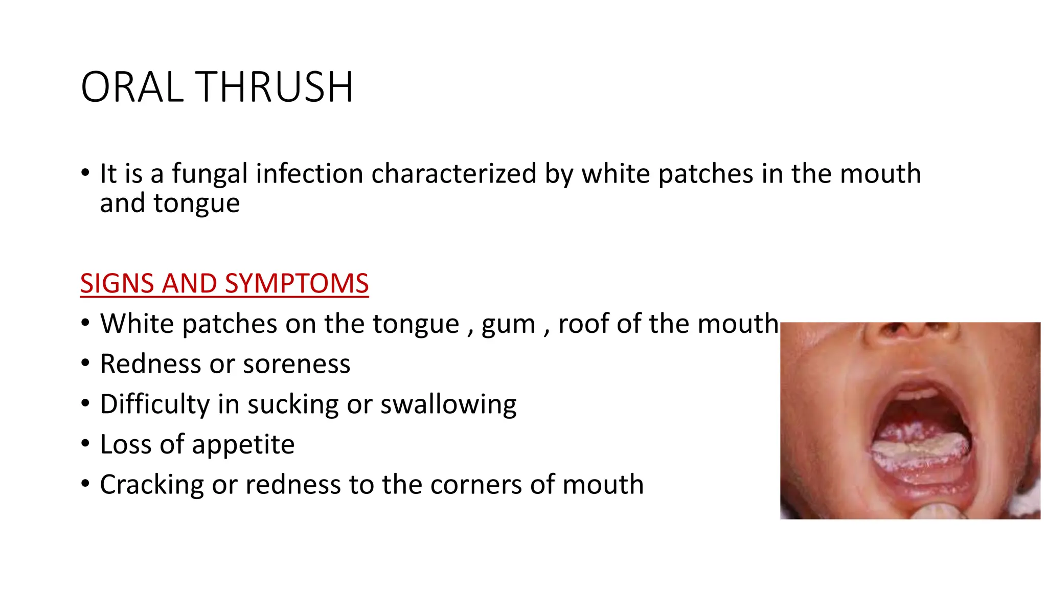 MINOR DISORDERS OF NEWBORN AND IT’S MANAGEMENT.pptx