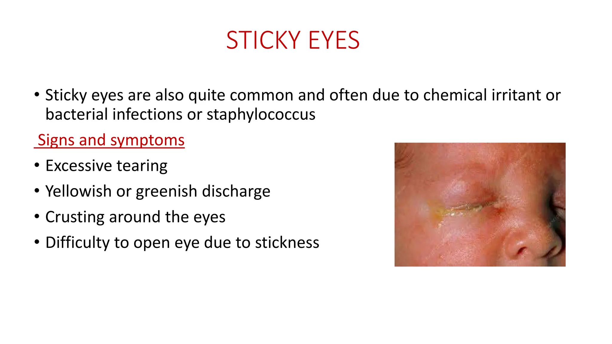 MINOR DISORDERS OF NEWBORN AND IT’S MANAGEMENT.pptx