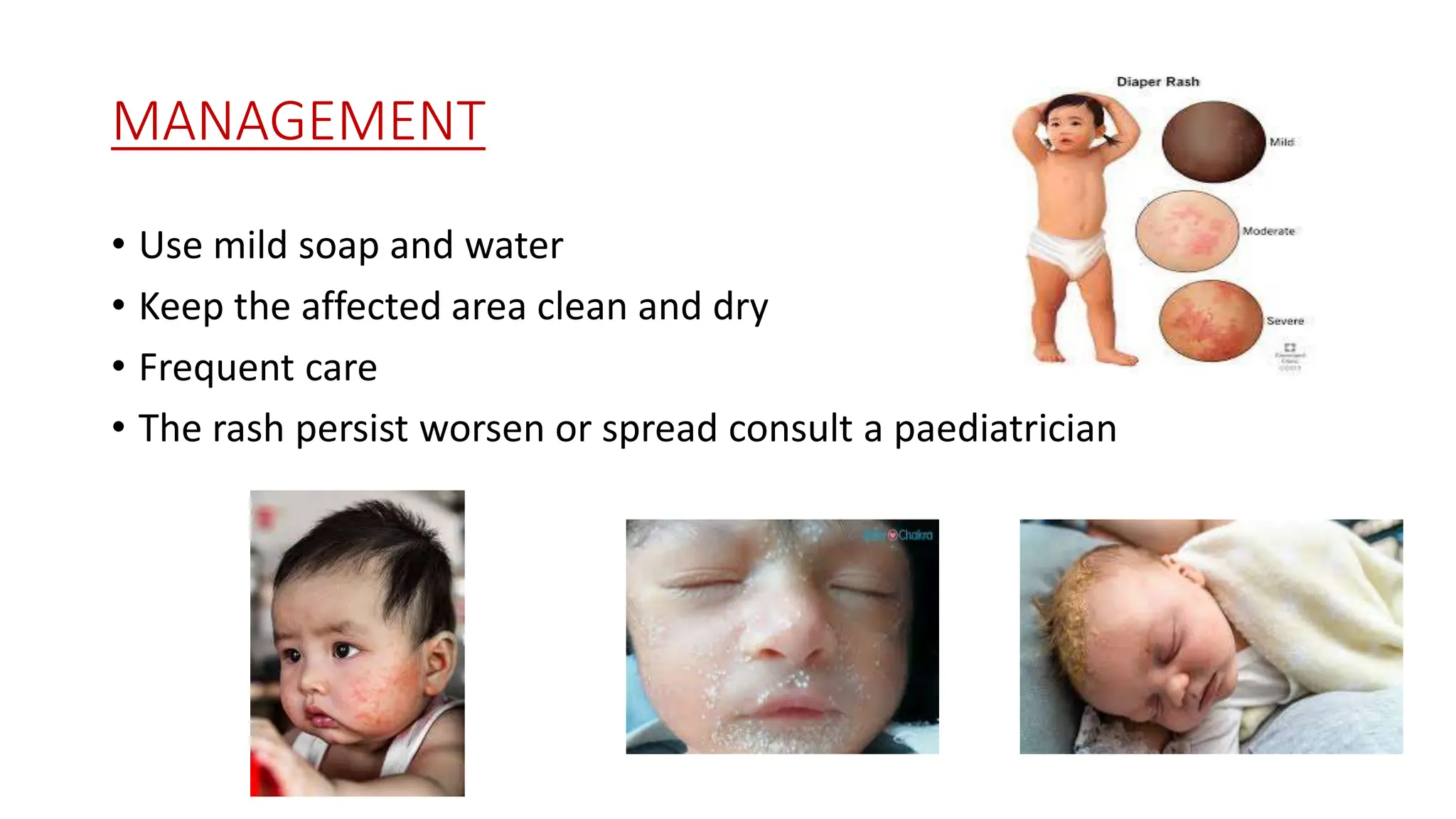 MINOR DISORDERS OF NEWBORN AND IT’S MANAGEMENT.pptx