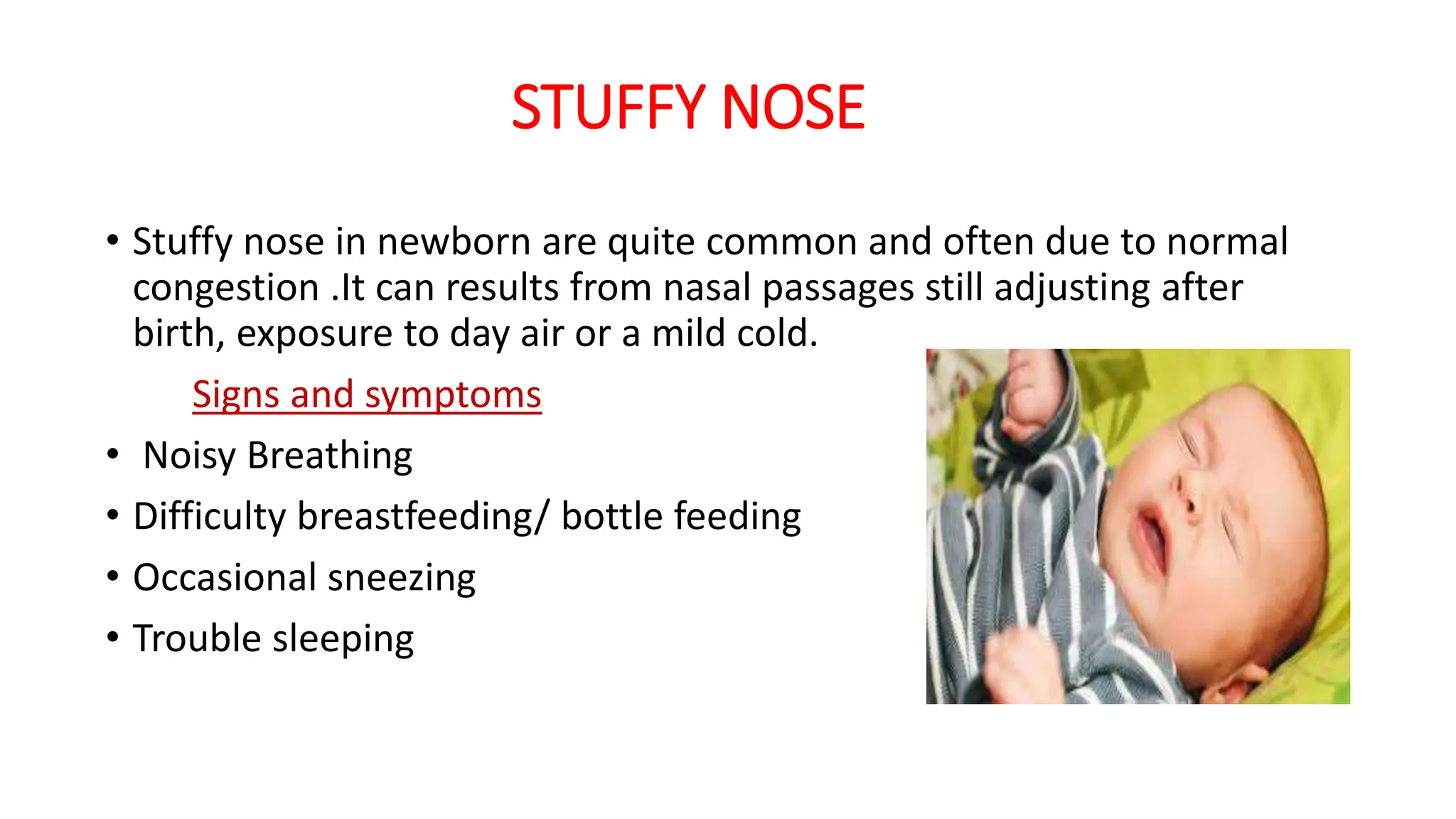 MINOR DISORDERS OF NEWBORN AND IT’S MANAGEMENT.pptx