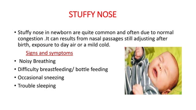 MINOR DISORDERS OF NEWBORN AND IT’S MANAGEMENT.pptx