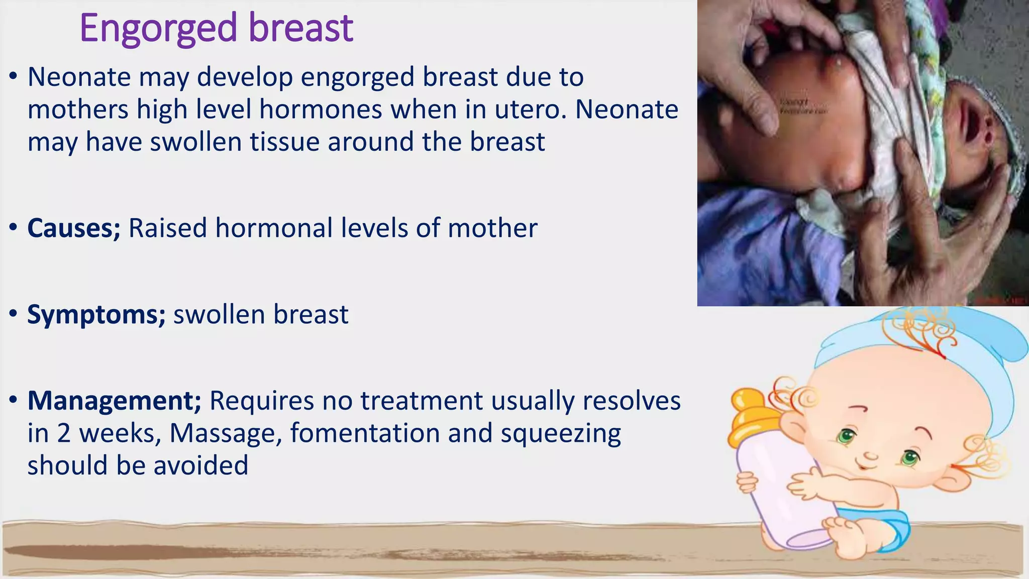 Minor disorders of puerperium | PPTX