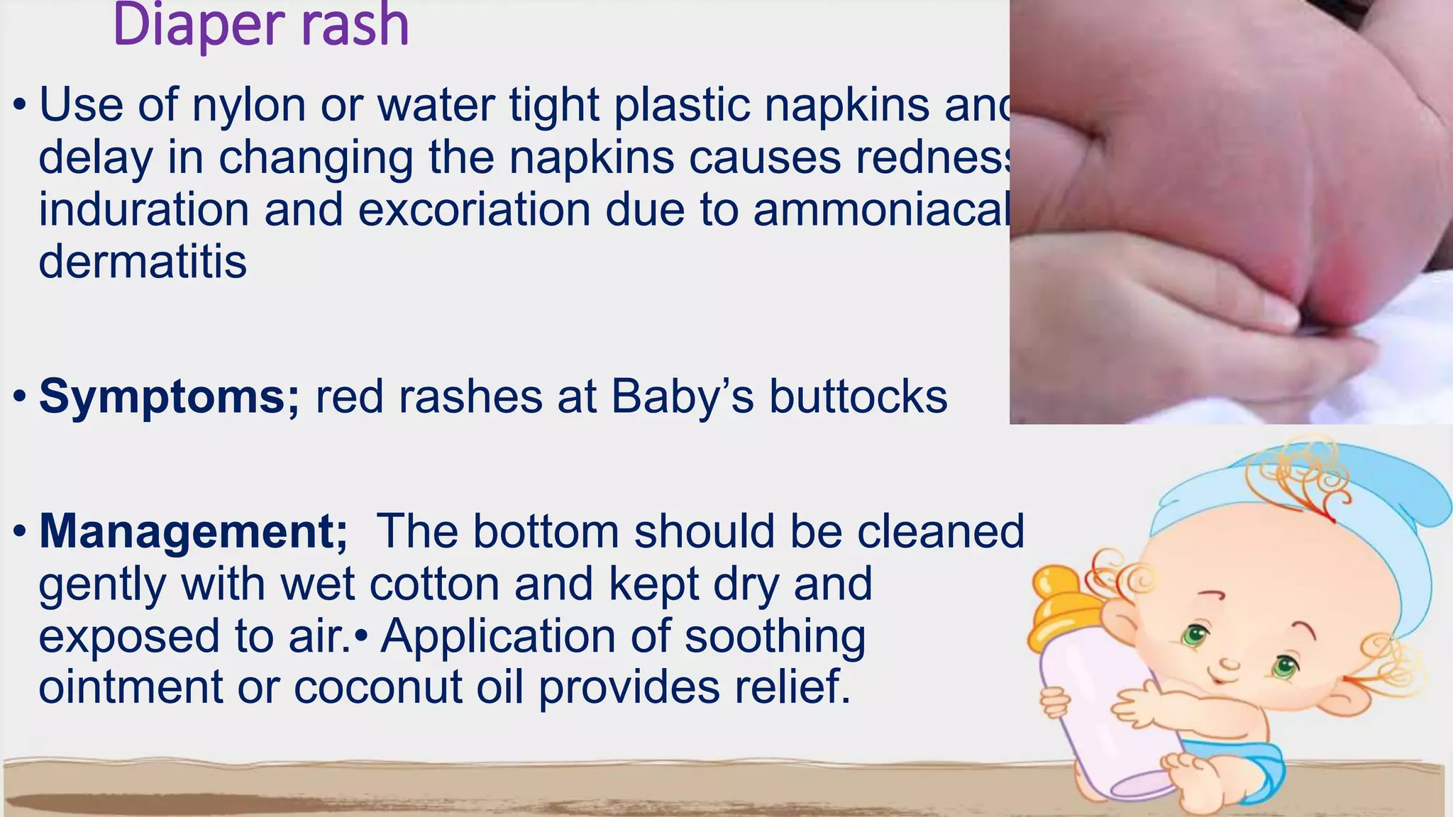 Minor disorders of puerperium | PPTX