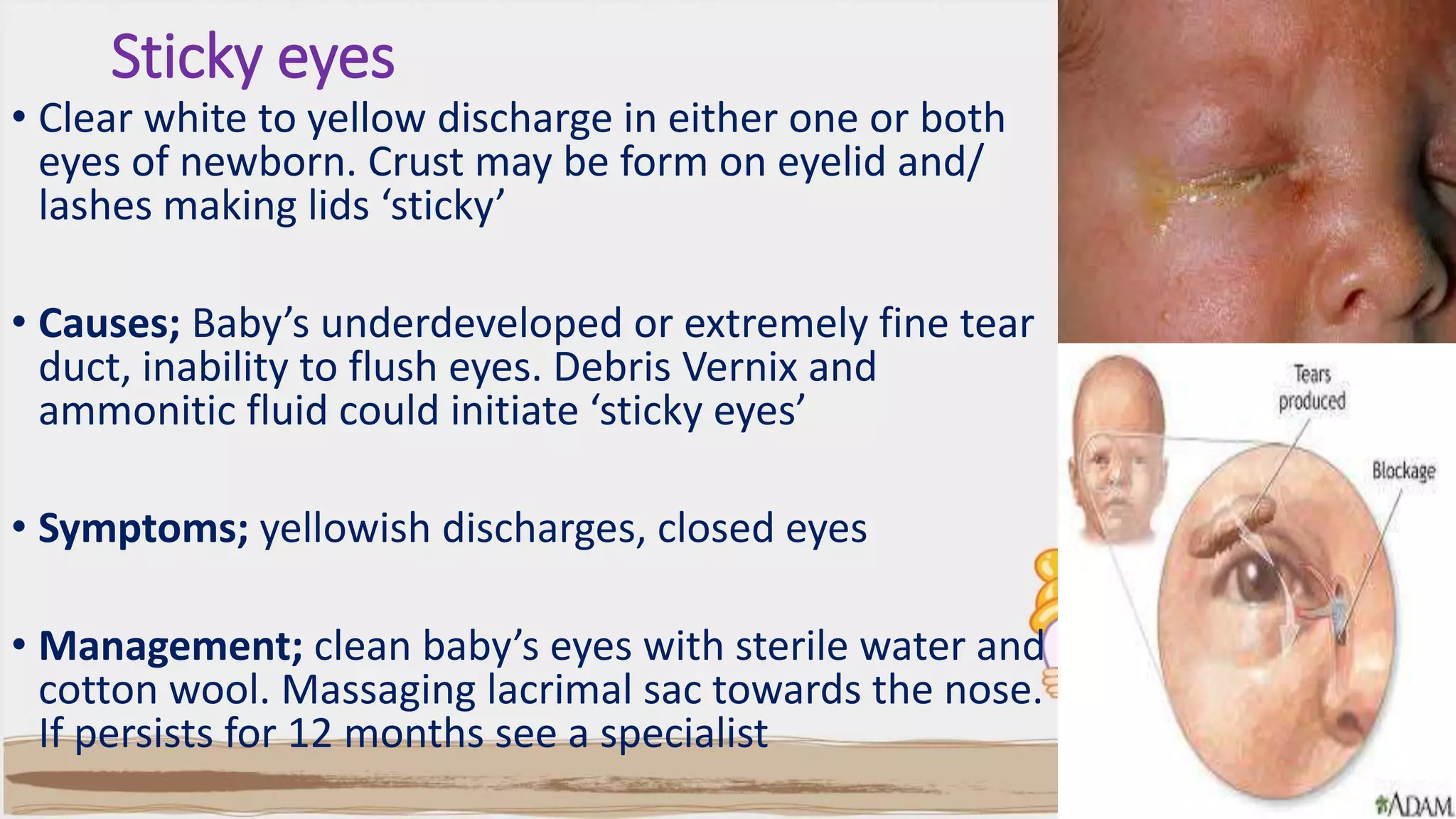 Minor disorders of puerperium | PPTX