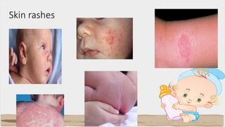 Minor disorders of puerperium | PPTX