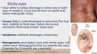 Minor disorders of puerperium | PPTX