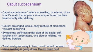 Minor disorders of puerperium | PPTX