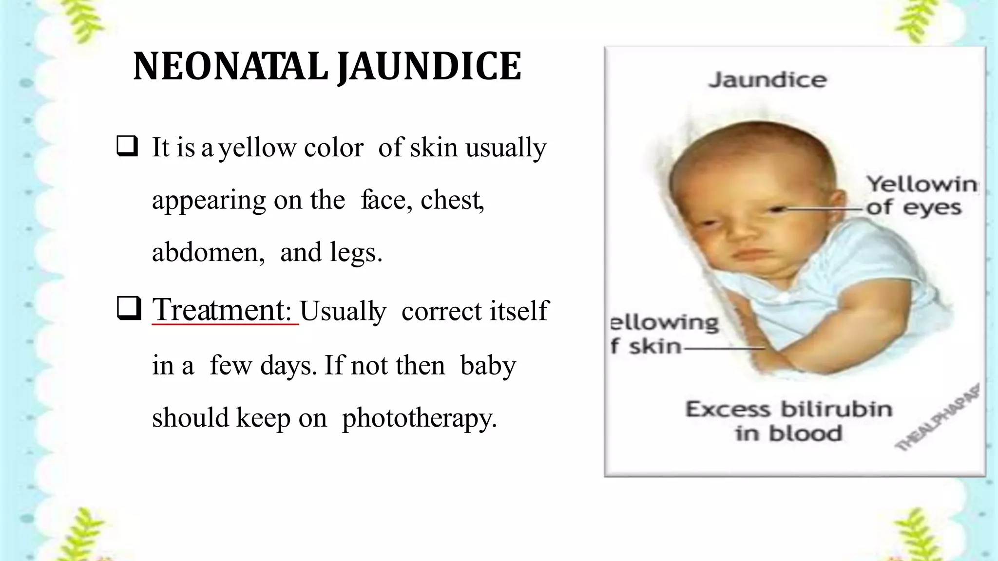 MINOR NB DISORDER NEWBORN | PPTX
