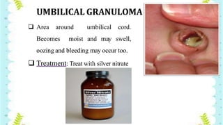 MINOR NB DISORDER NEWBORN | PPTX