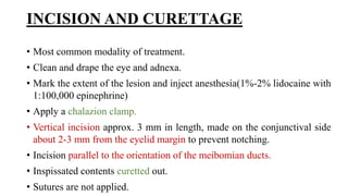 Minor ophthalmic procedures and instruments | PPTX