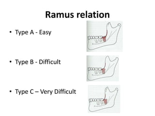 Mandibular impacted third molar removal | PPTX | First Aid | Injuries