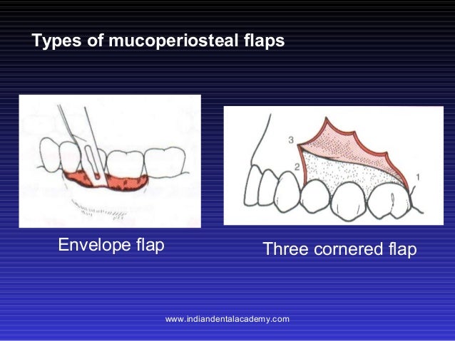 Minor oral surgical principles /certified fixed orthodontic courses b…