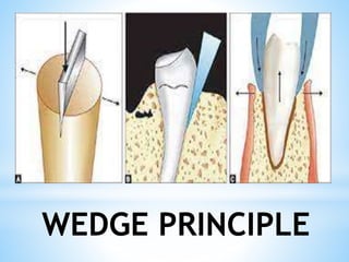 minor oral surgical procedures final.pptx