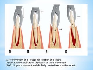minor oral surgical procedures final.pptx