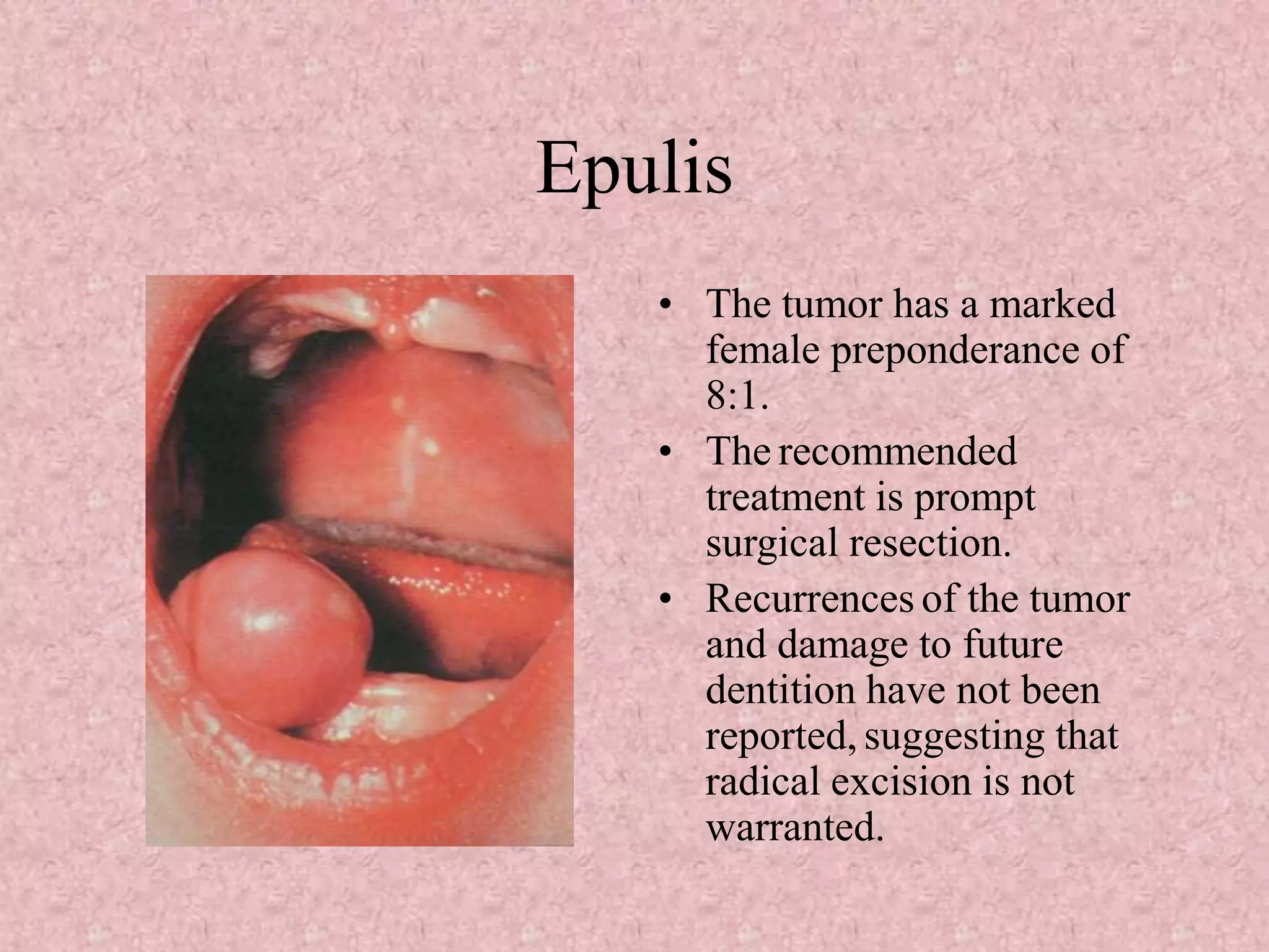 Minor oral Surgical Procedures in Children.ppt