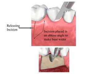 Minor oral Surgical Procedures in Children.ppt