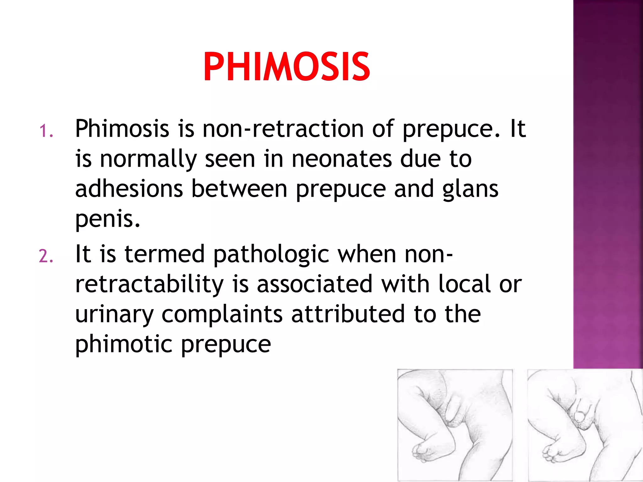 Common neonatal problems | PPTX