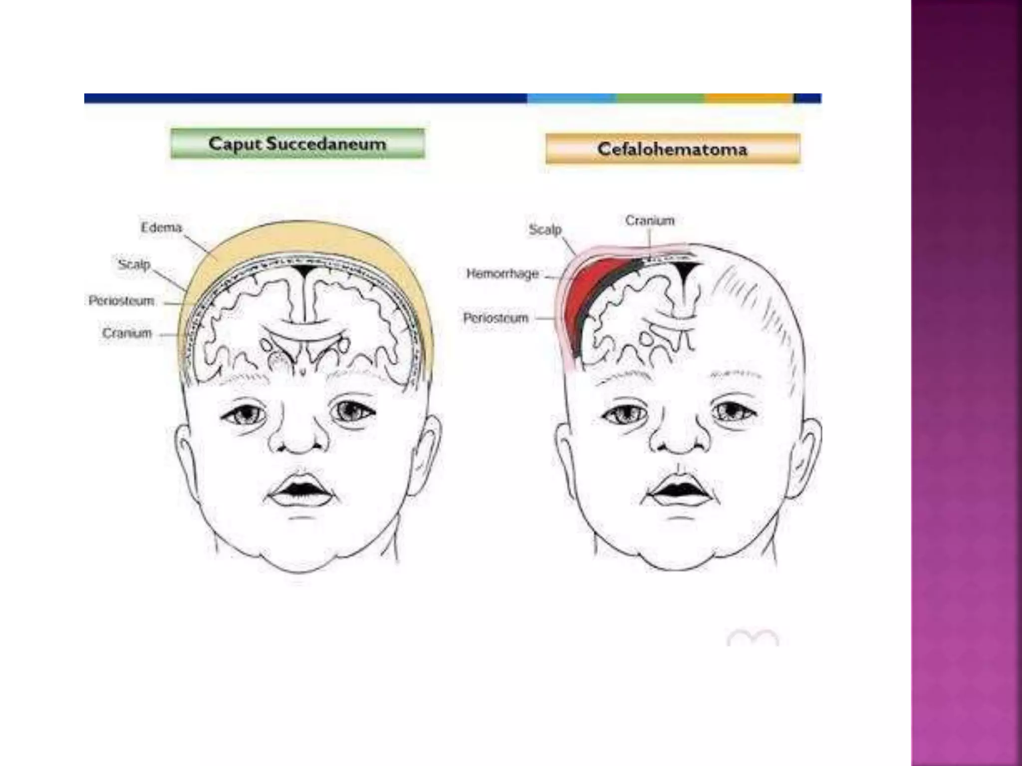 Common neonatal problems | PPTX