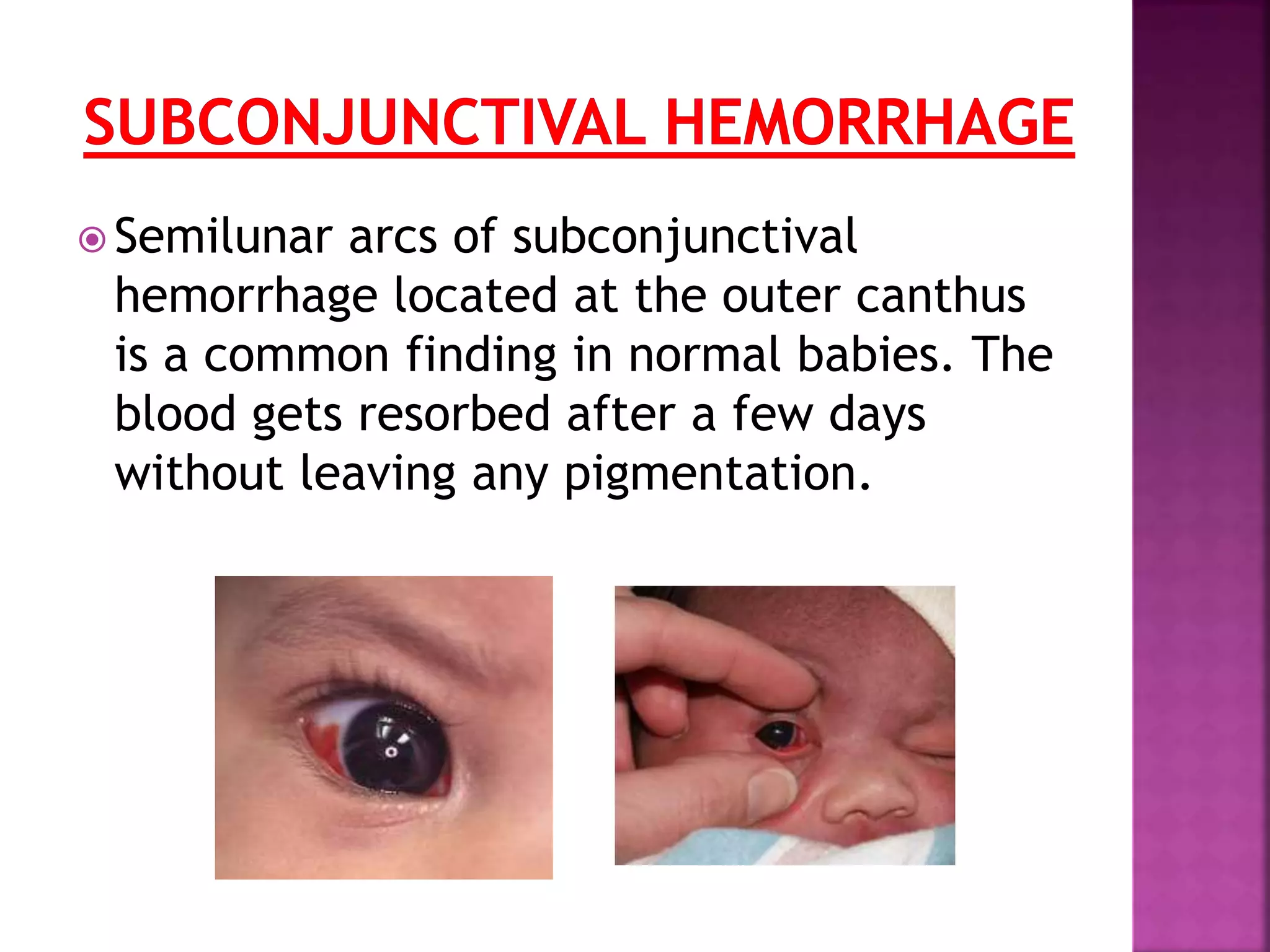 Common neonatal problems | PPTX