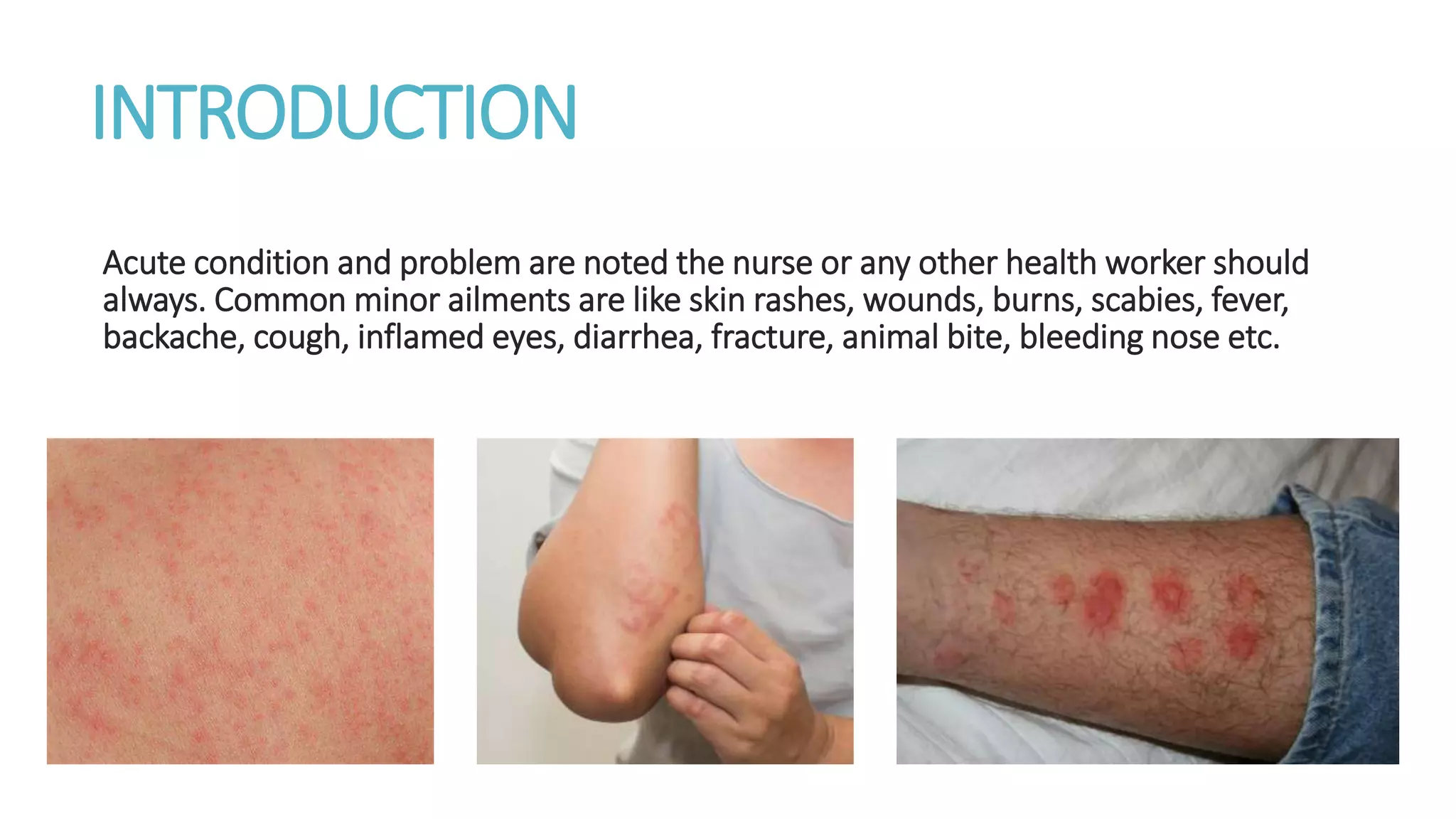 minor skin ailments.pptx