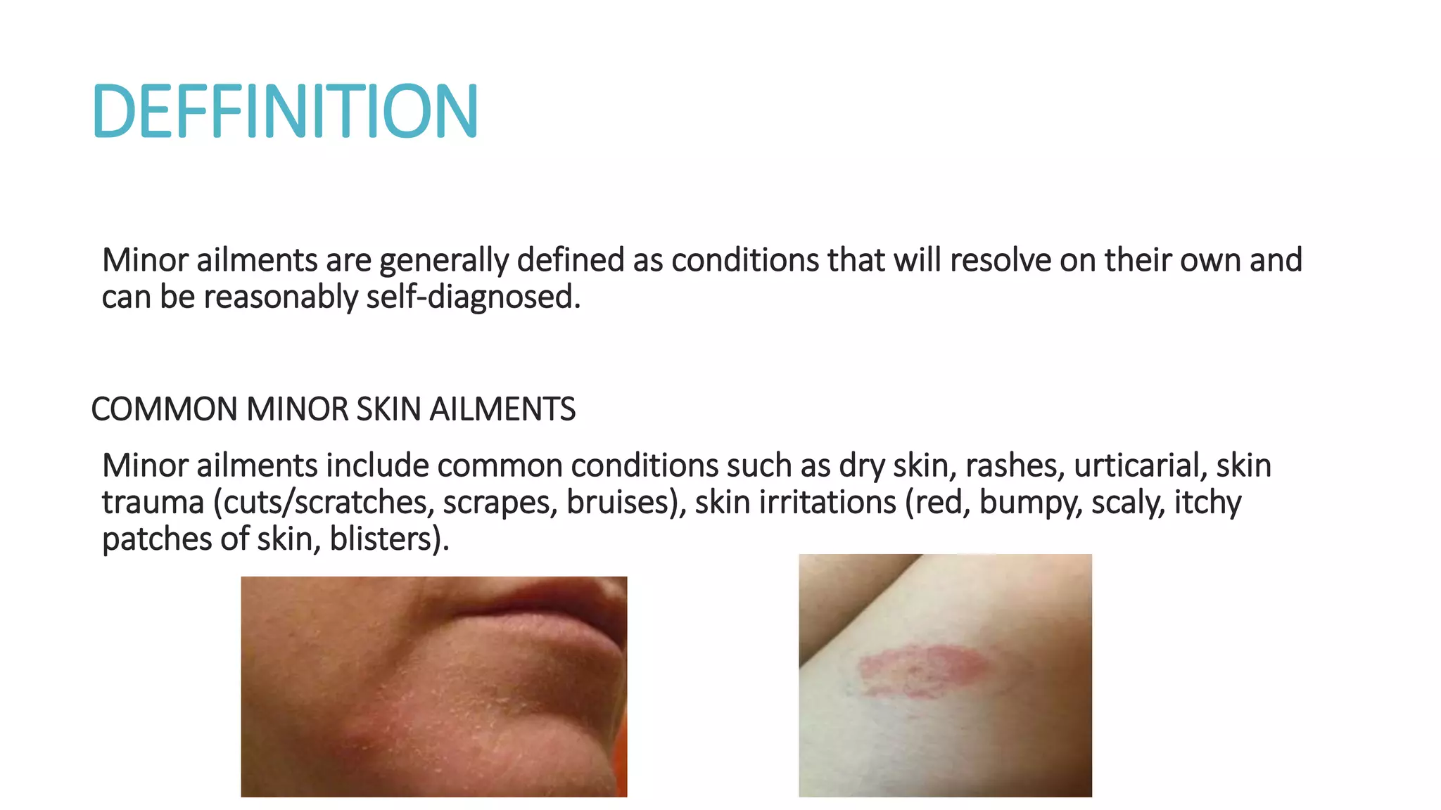 minor skin ailments.pptx