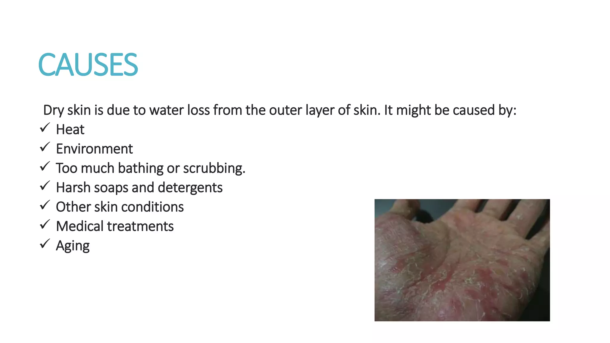 minor skin ailments.pptx