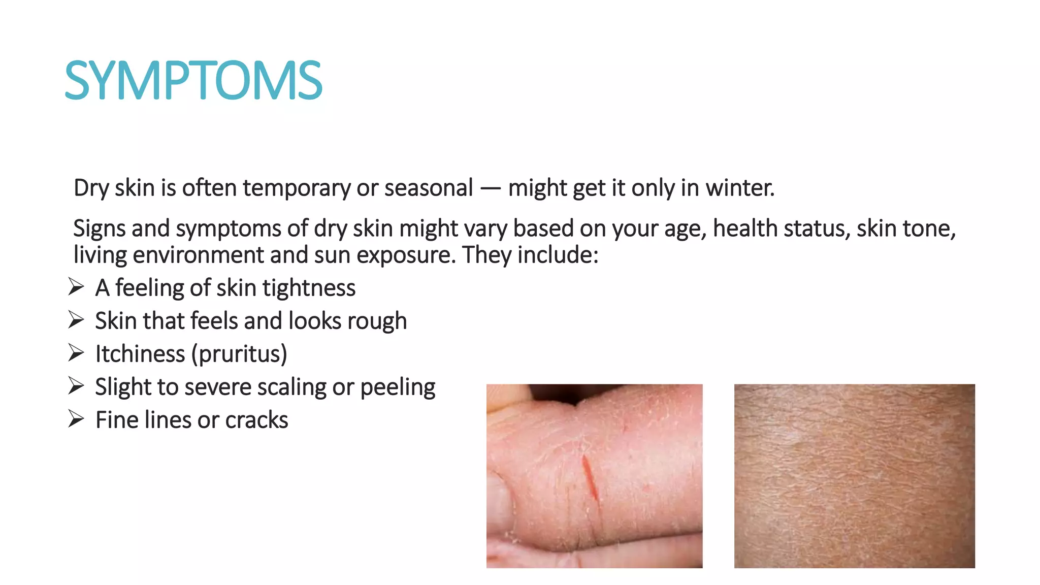 minor skin ailments.pptx