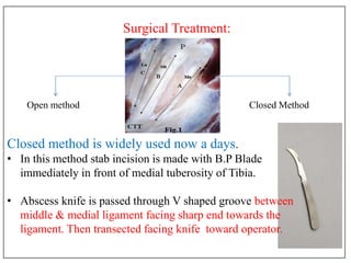 Minor surgical conti | PPTX | Death, Injury, or Military Conflict ...