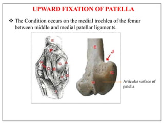 Minor surgical conti | PPTX