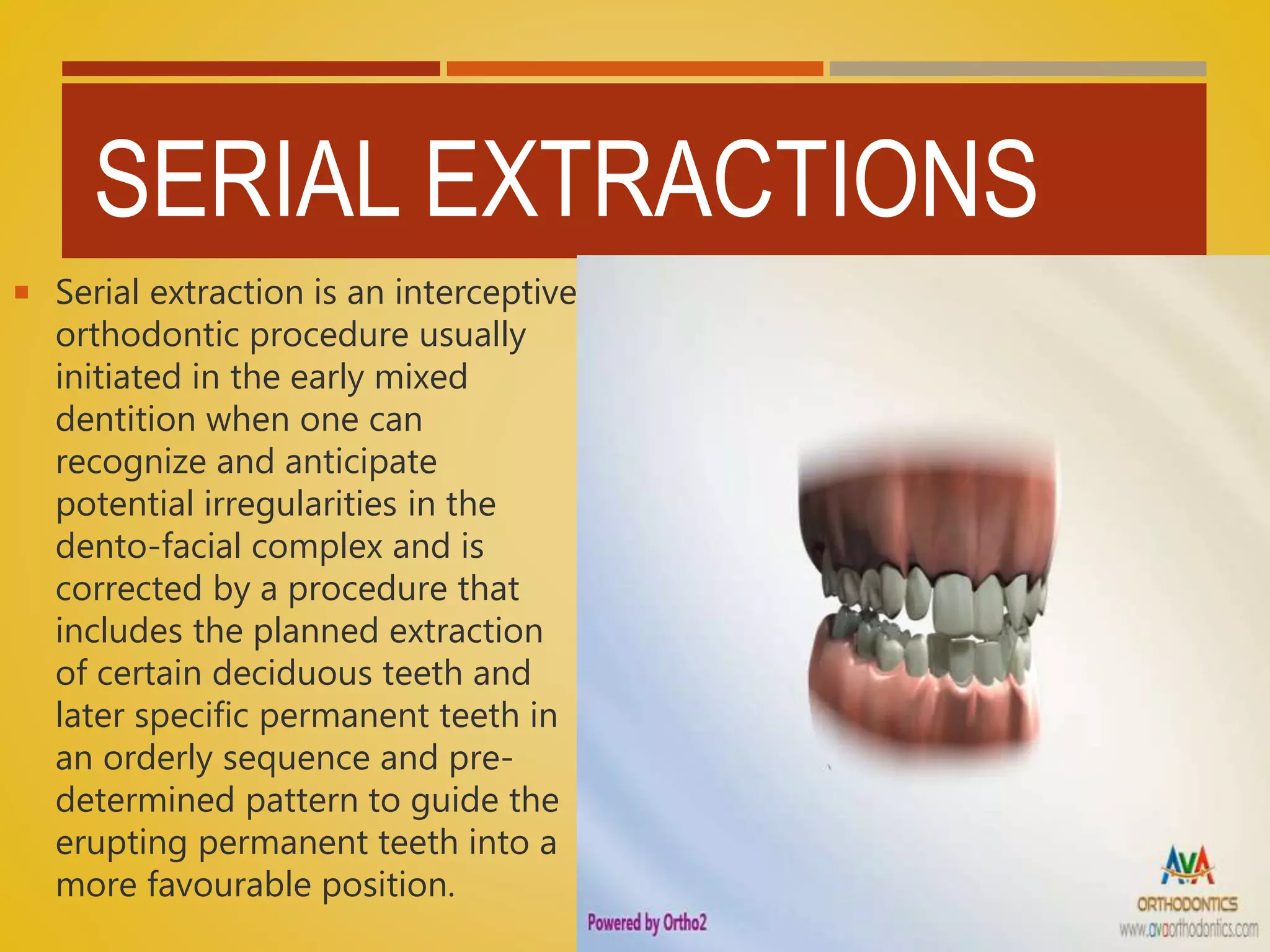 Minor surgical procedures in Orthodontics | PPTX