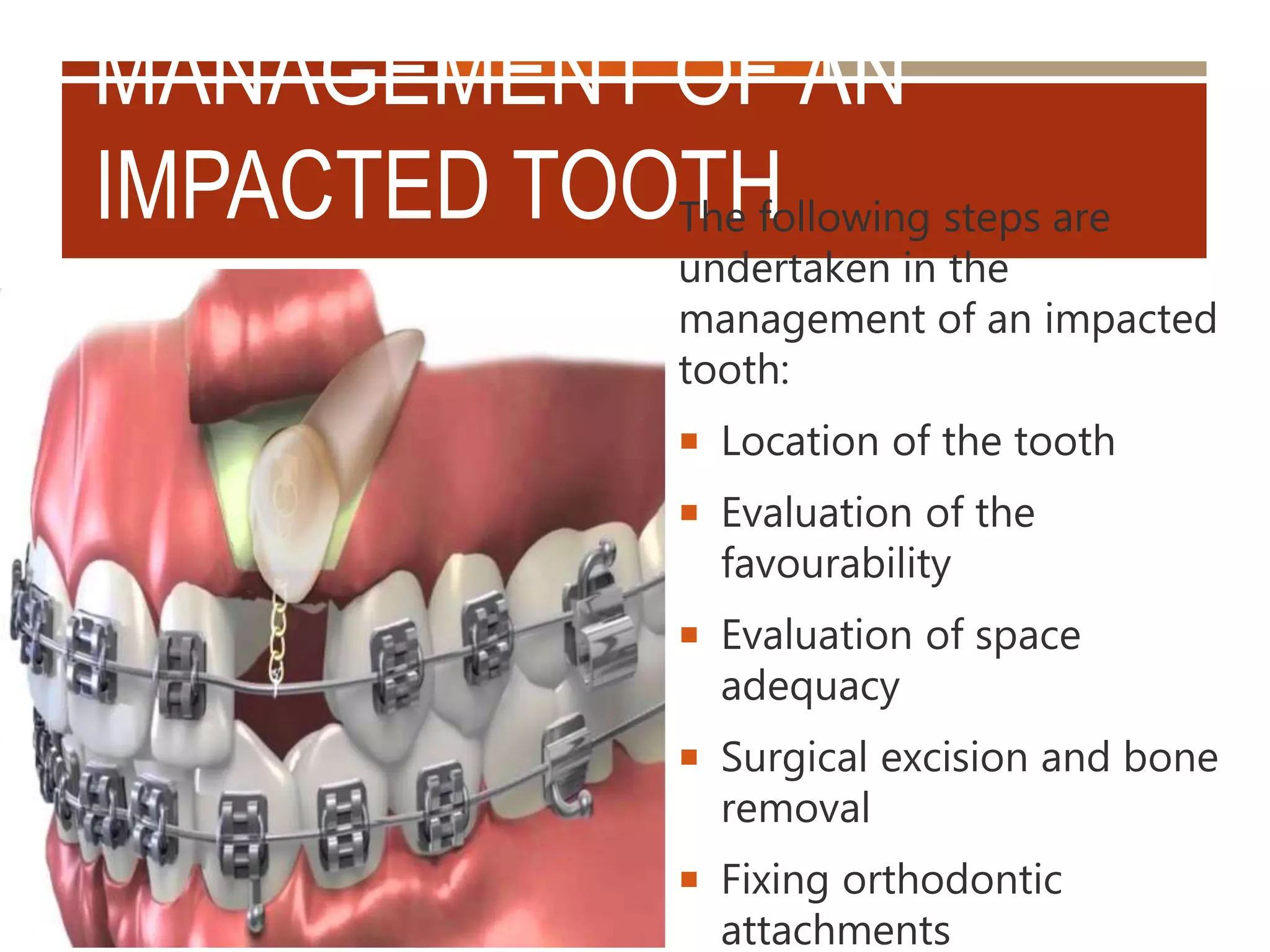 Minor surgical procedures in Orthodontics | PPTX
