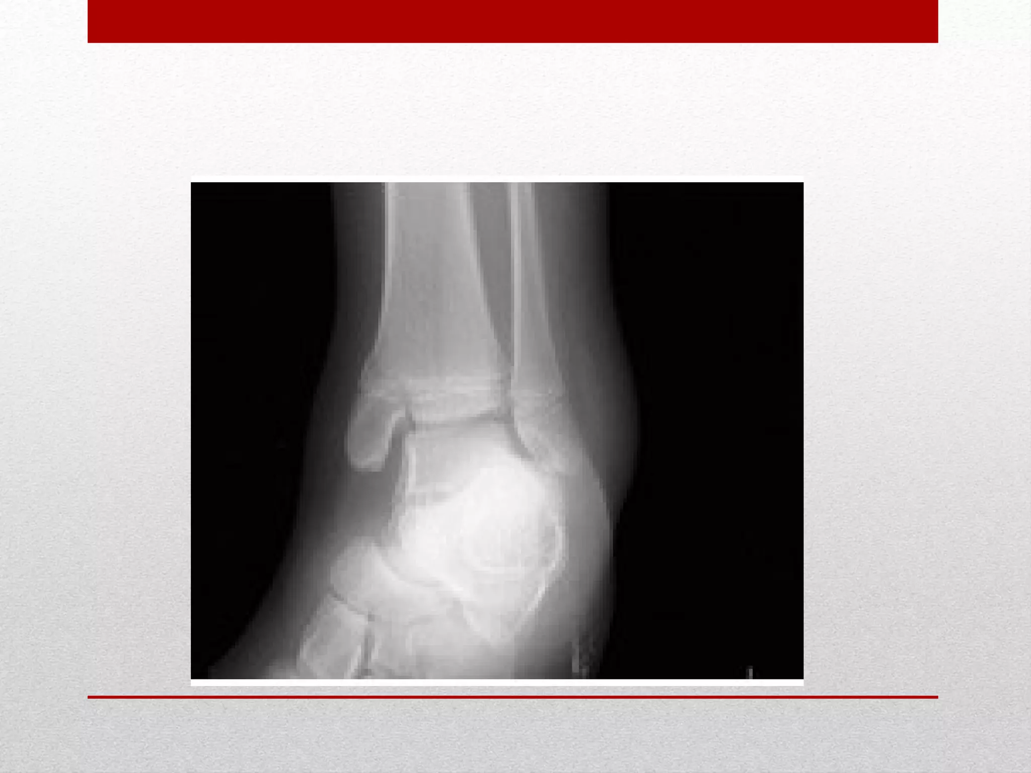 Paediatric Minor Trauma | PPT