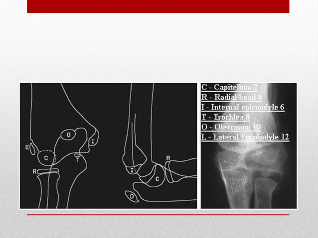 Paediatric Minor Trauma | PPT