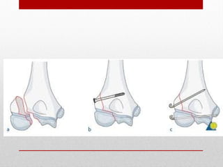 Paediatric Minor Trauma | PPT