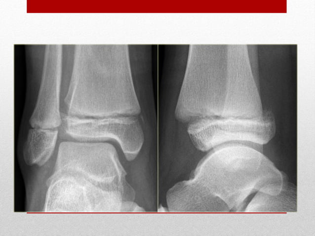 Paediatric Minor Trauma | PPT