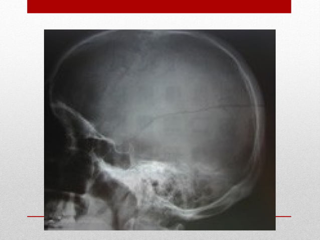 Paediatric Minor Trauma | PPT