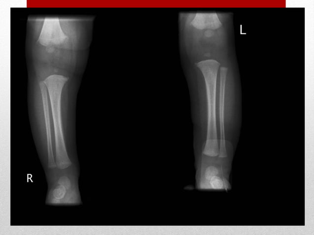 Paediatric Minor Trauma | PPT