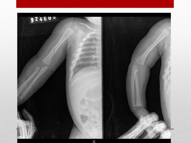 Paediatric Minor Trauma | PPT